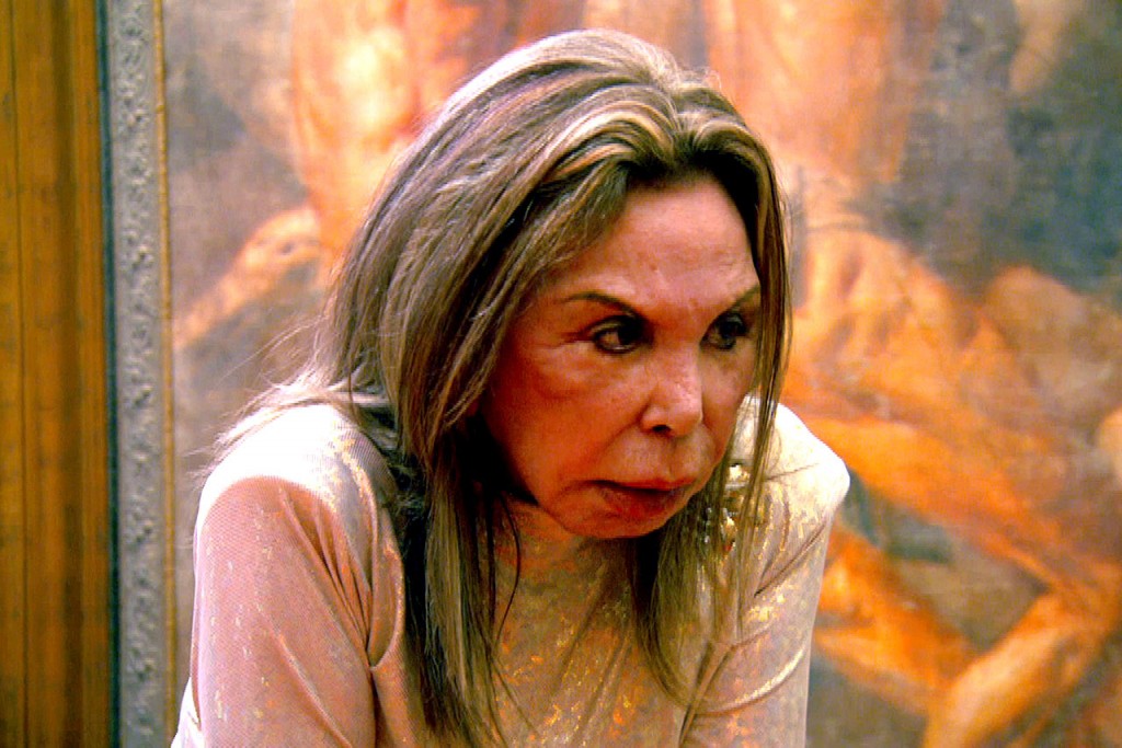 Chatter Busy: Elsa Patton Plastic Surgery