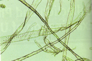 Urine Artifacts ~ Medical Labs Everyday