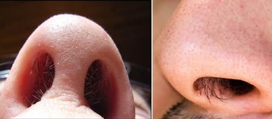 NGERI!! BAHAYA HIDUNG ROMPONG AKIBAT CABUT BULU HIDUNG ?? ~ cute mute