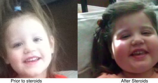 Hugs for Hailey: Moon Face