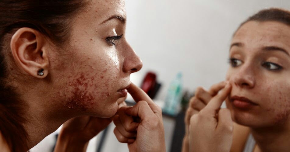 Green health consultation centre: FAHAMU CHANZO CHA CHUNUSI,AINA ZA ...