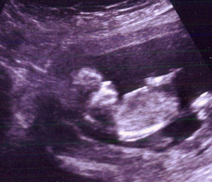 Something More...: I see a nose!