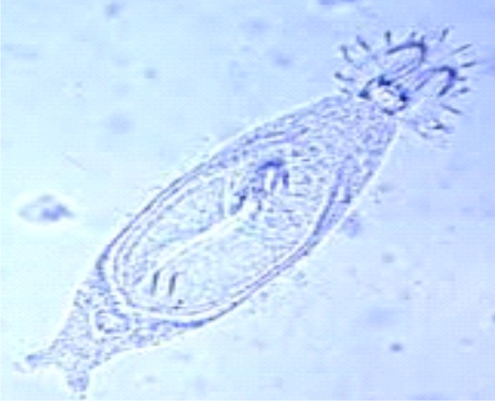 Penyakit Parasit Pada Ikan (1) - Lalaukan