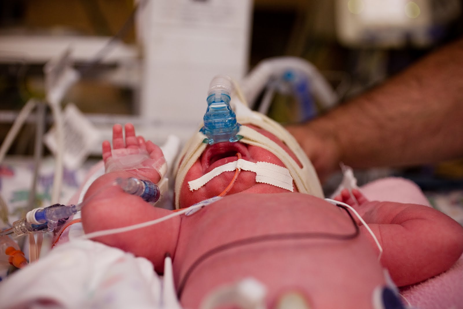The life He gives us: NICU