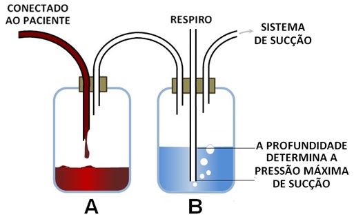 O Guia do Fisioterapeuta: Como funciona o dreno de tórax.