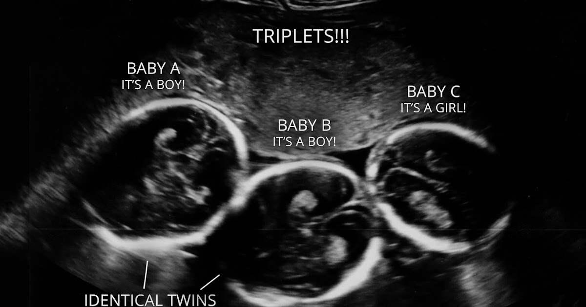 Dining with Danielle: 18 Week Anatomy Scan