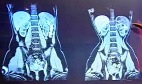 Quer saber como o corpo fica por dentro quando se está de corset ...