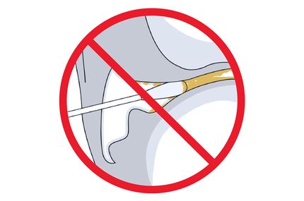 Ohren sollen sauber sein: Ohrenschmalz Pfropf, was nun??