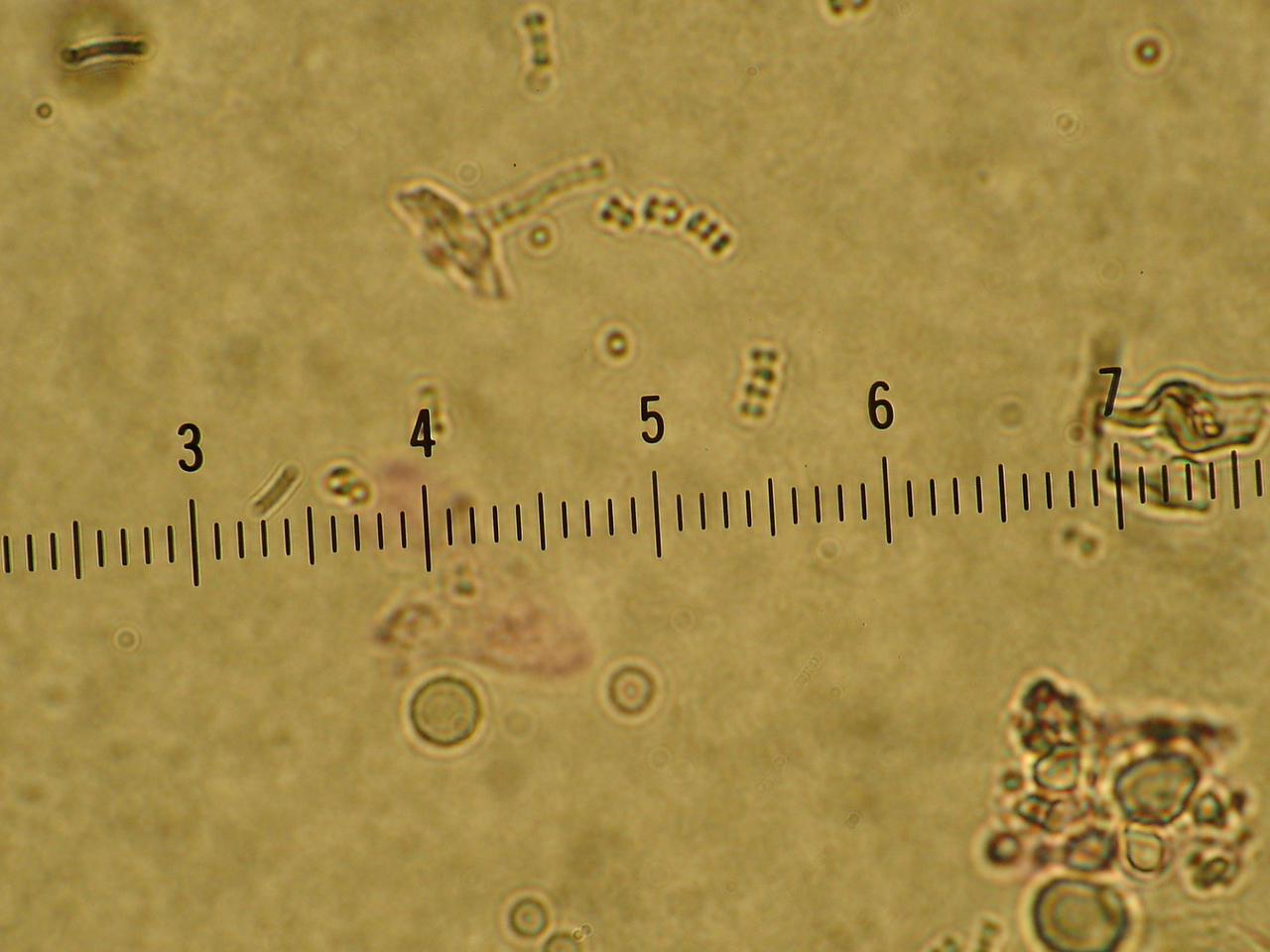 Sustainable Mycology: Wallemia spp.