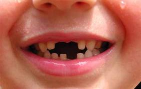 Delaware County Wellness Wednesday: Healthy Teeth