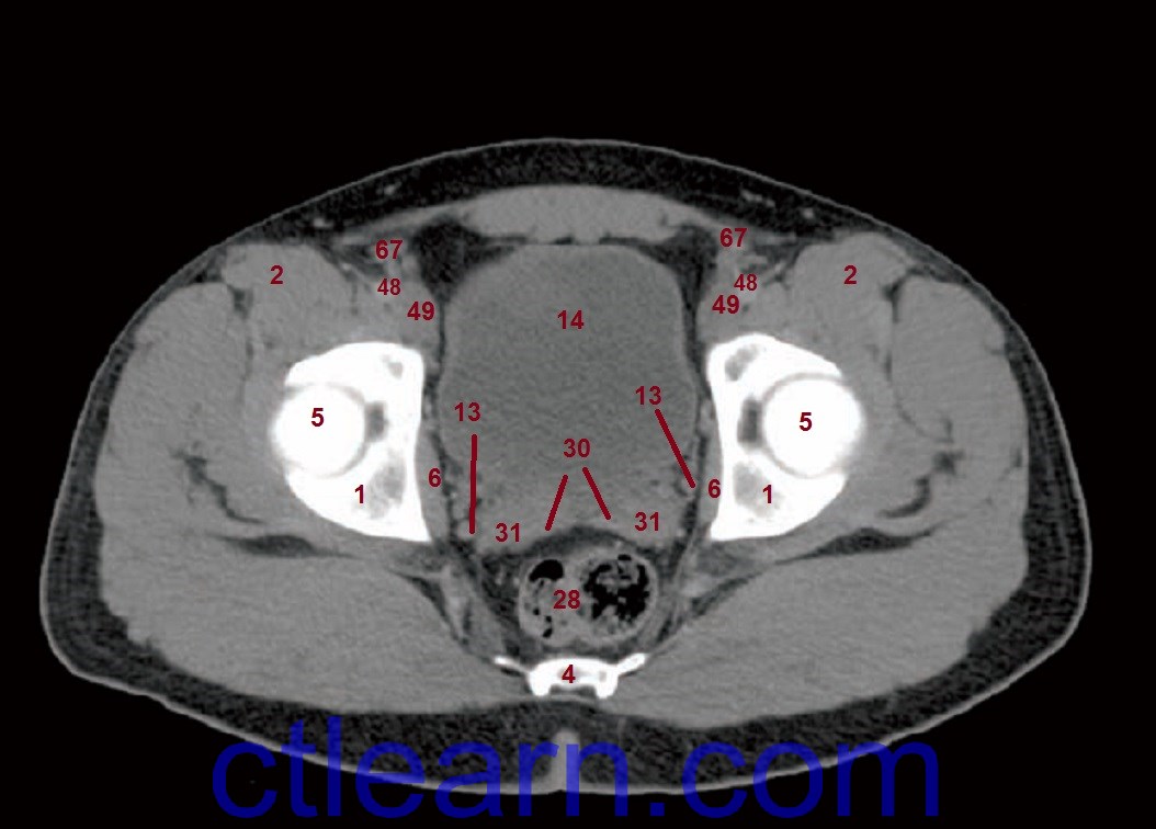 Anatomy CT Axial Abdomen and Pelvis Male