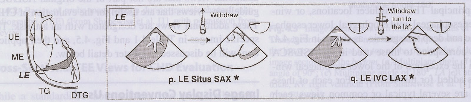 Pedi Cardiology Tee Basic Views And Terminology