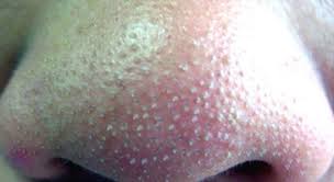 rumah inka: JENIS-JENIS KOMEDO