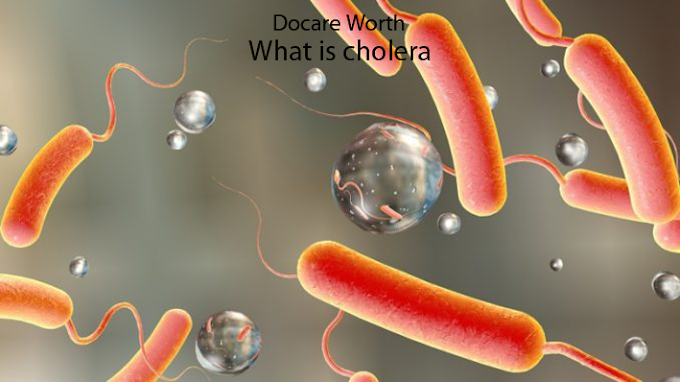 Cholera: Causes, Symptoms, Diagnosis, complications