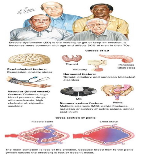 Understand Erectile Dysfunction before You Regret