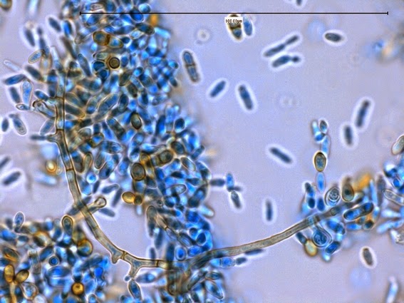 Fun With Microbiology (What's Buggin' You?): Hortaea werneckii