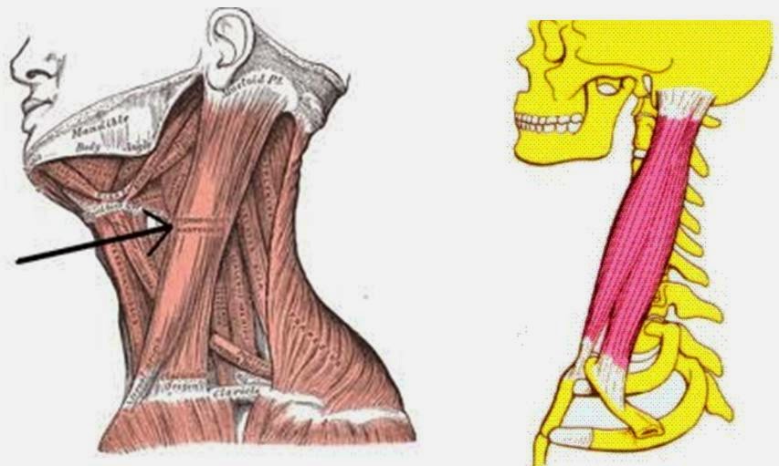 Morfofunción: Cabeza y cuello: Esternocleidomastoideo