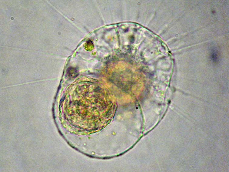 Beyond the Human Eye: Life in 10 Drops of Water: Assorted Protists and ...