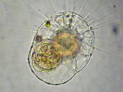 Beyond the Human Eye: Life in 10 Drops of Water: Assorted Protists and ...