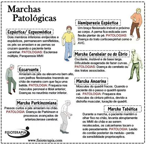 Fisiopediatria Sem Limites: TIPOS DE MARCHA