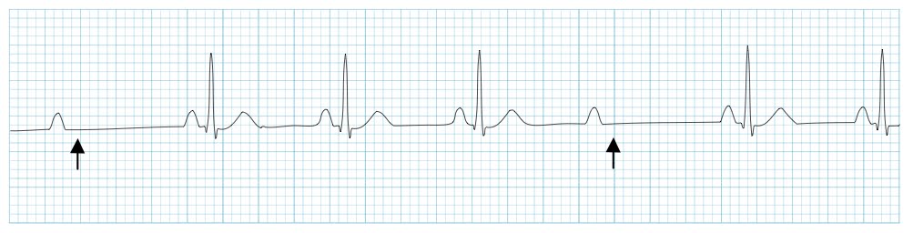 ER goldbook: EKG interpretation