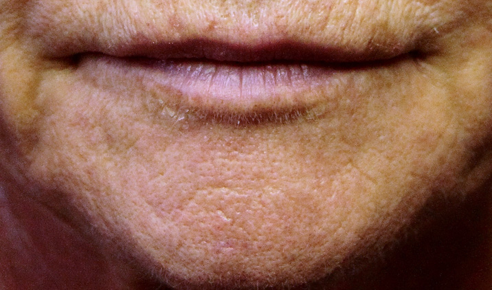 Dott. Stefano Vierucci Medicina e Chirurgia Estetica: LA CHIRURGIA NON ...