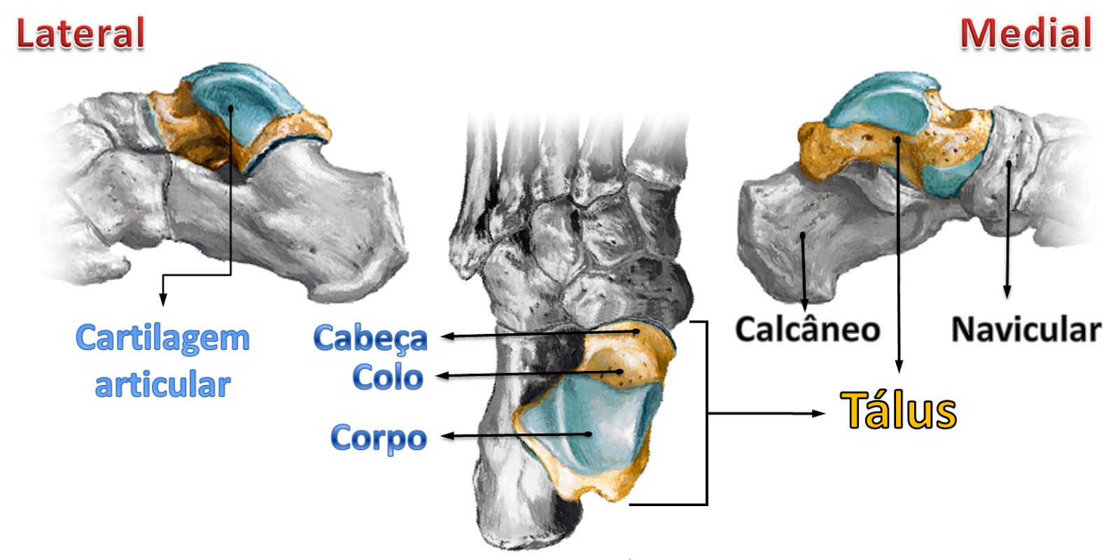 Clínica e Cirurgia do Pé e Tornozelo: Fraturas do Tálus