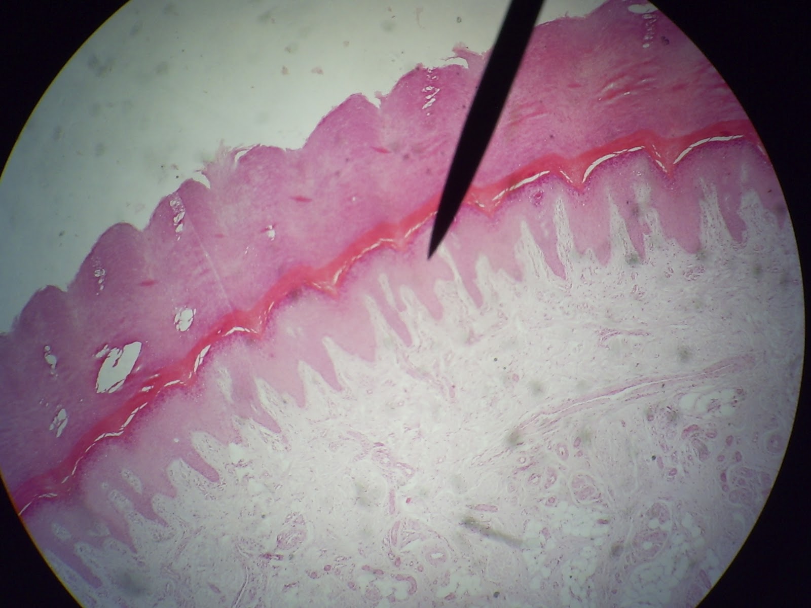 MEDICINA USMP: FOTOS DE HISTO SISTEMA NERVIOSO