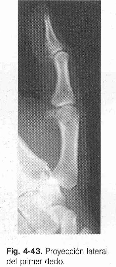 tecradiologos: PRIMER DEDO (PULGAR).
