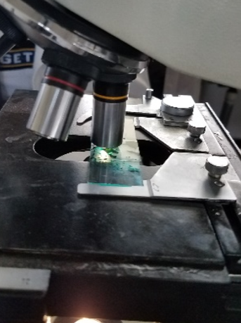 Laboratorioclinico63fv: Prueba Kato Katz