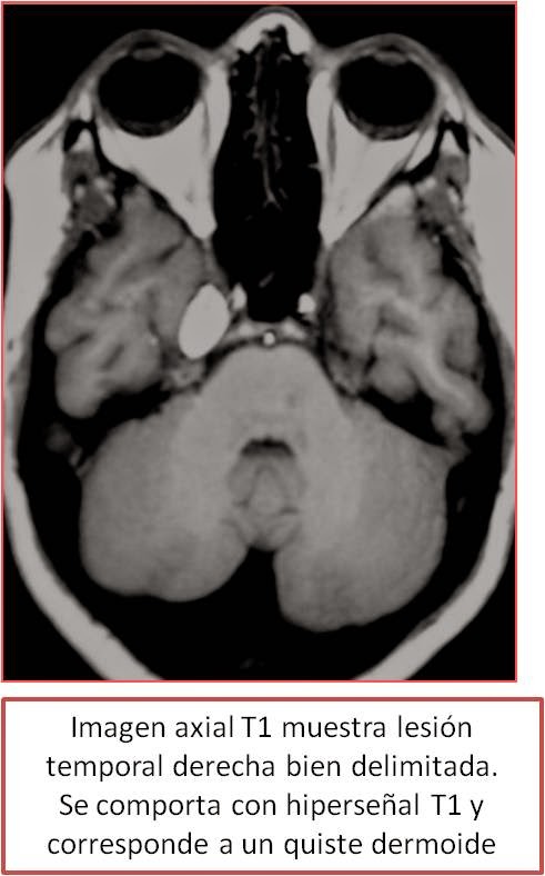 ESPE 203-2013: Patología de región selar: rol de imagenología