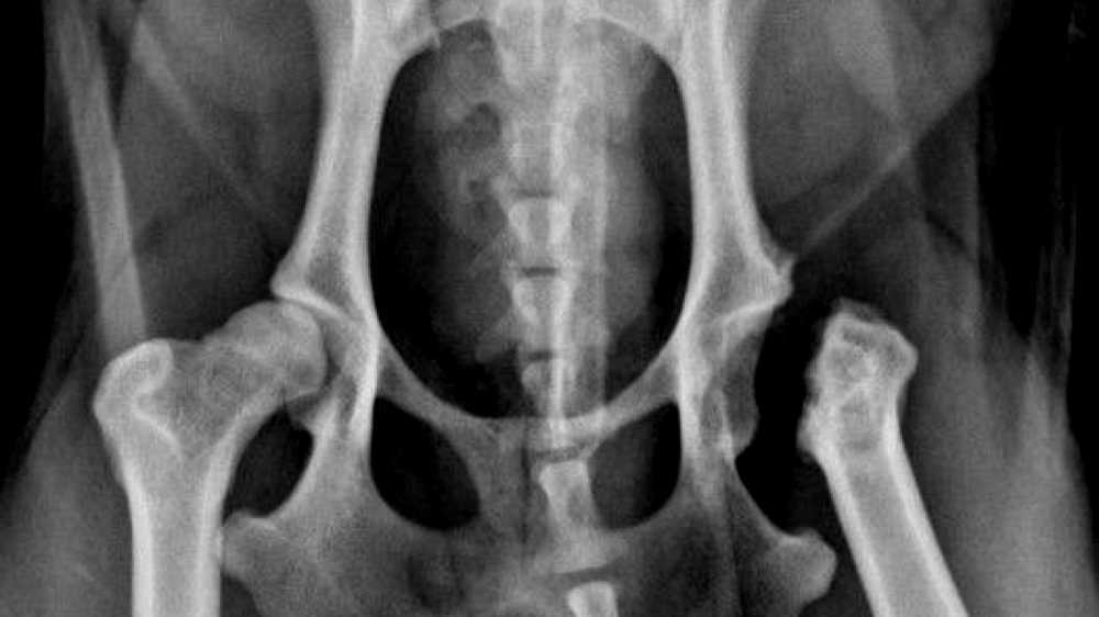 Femoral head ostectomy