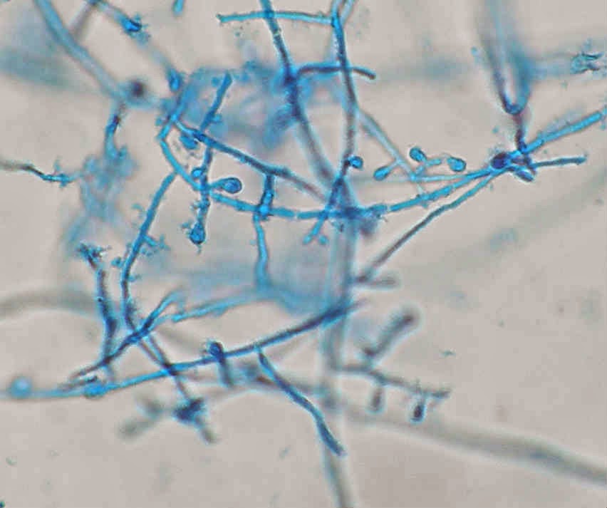 ATLAS MICOLOGIA: CHRYSOSPORIUM KERATINOPHILUM
