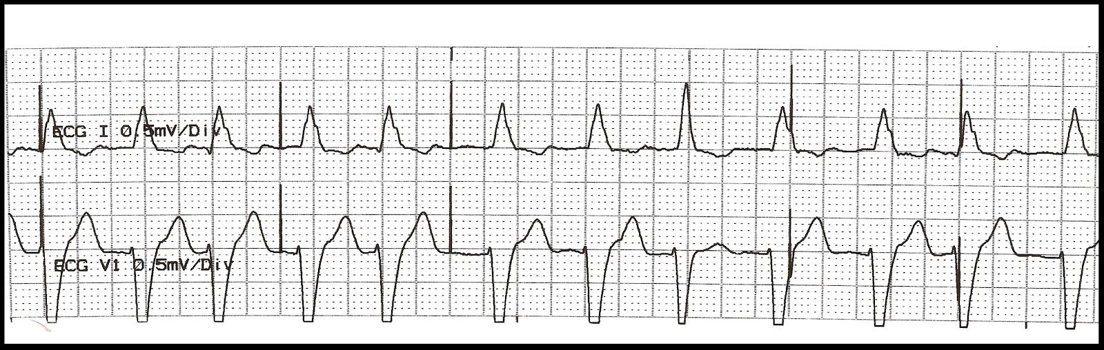 EKG Quiz 350
