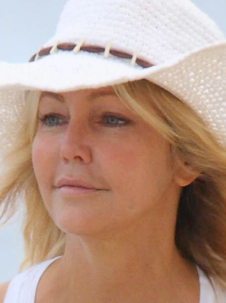 Heather Locklear Cheeks and Filler Plastic Surgery Before and After ...