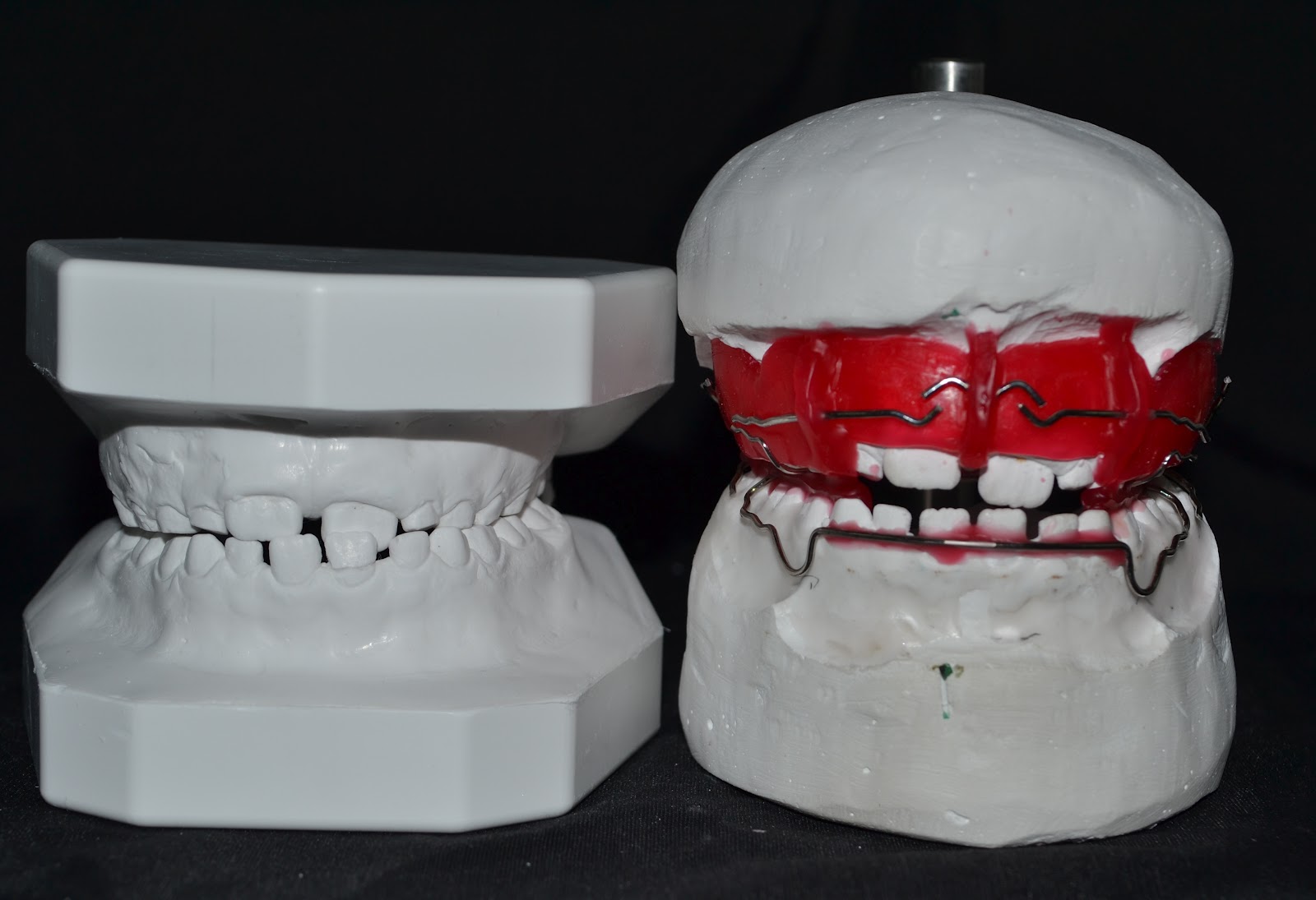 Laboratorio Ortodontico MRdental: FRANKEL 3