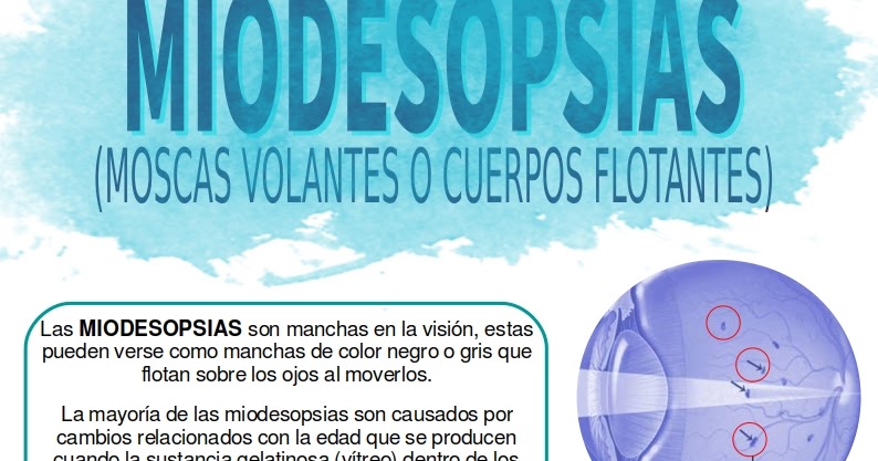 Clínica de Ojos Oftalmic Láser: MIODESOPSIAS
