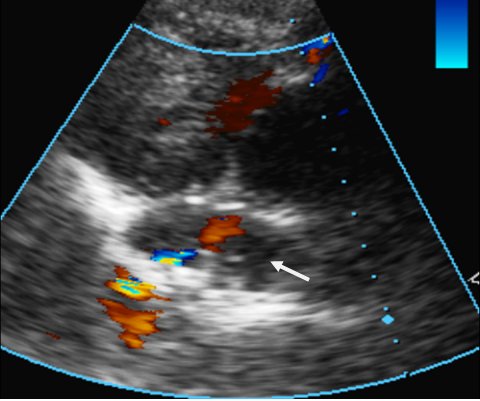 Medical Instrumentation: EchoKardio (Cardiac Echo)