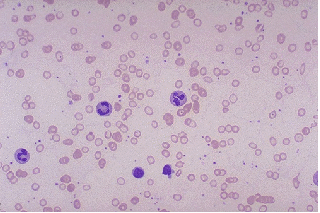 Fichero de Hematologia