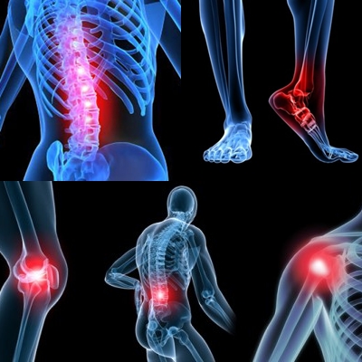 Waspadai Penyakit Rematik Tulang | Grosir Eceran Jelly Gamat Gold-G