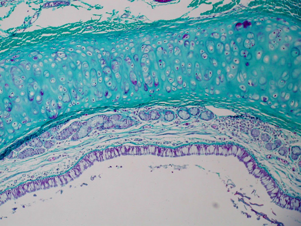 SOS BIOLOGIA CELULAR Y TISULAR: RESPIRATORIO. BRONQUIO
