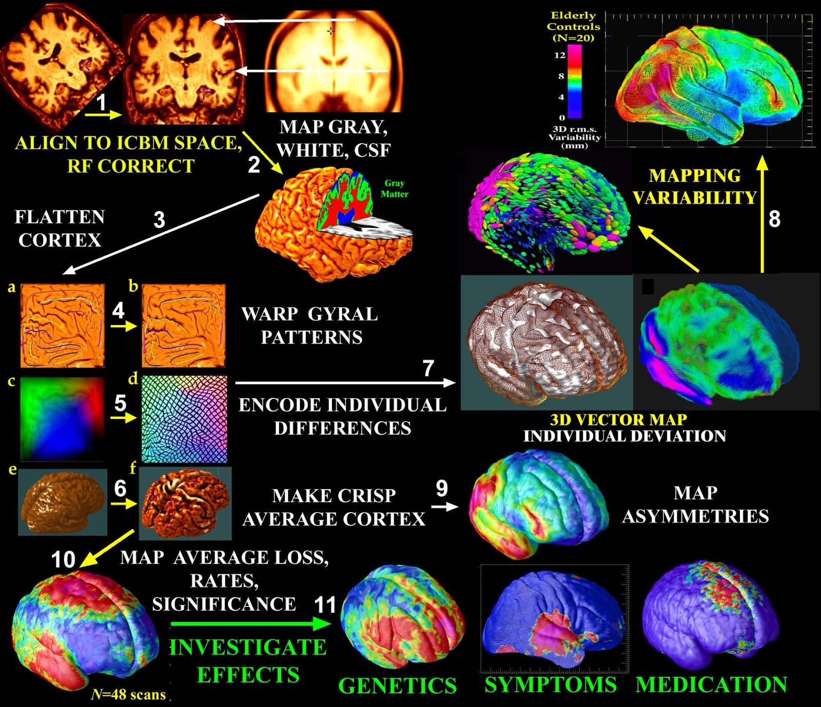 Brain Jack Image: Brain Imaging