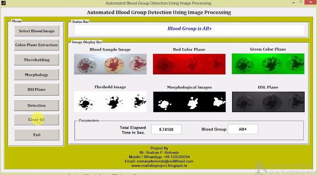 Blood Group Detection Using Image Processing Matlab Project with Source Code ~ ENGINEERING PROJECTS
