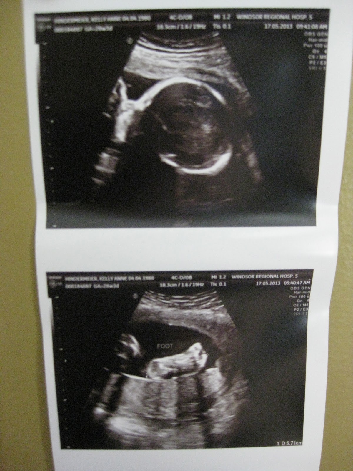 Operation: Make a Baby: 28 week ultrasound pictures!