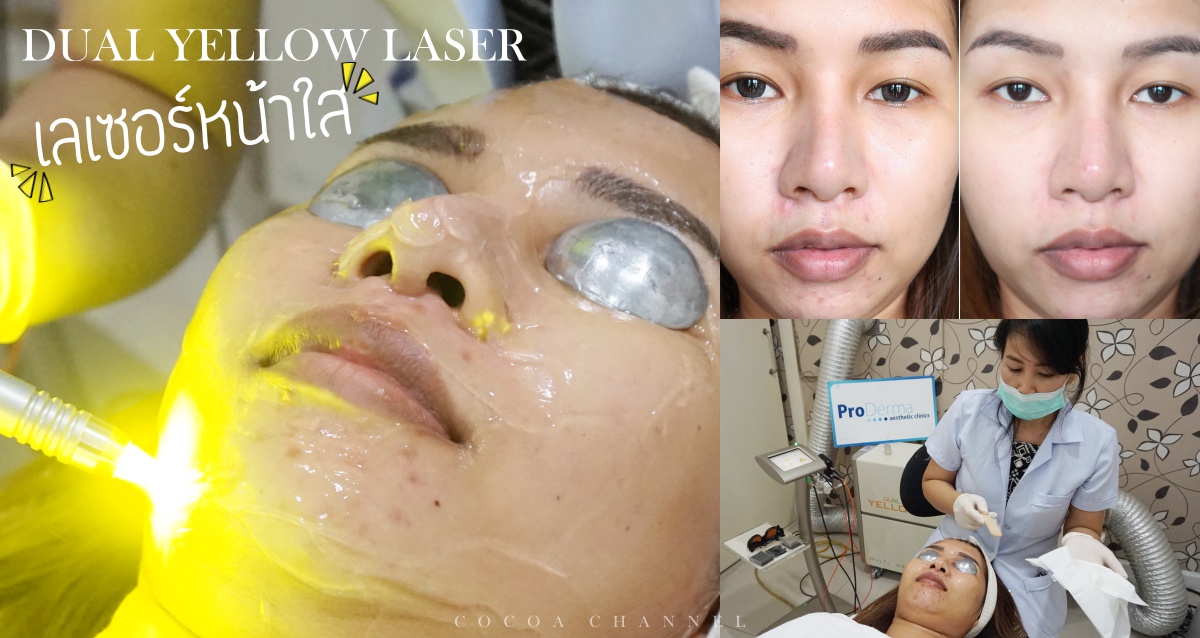 [ Review ] :: เลเซอร์หน้าใส DUAL YELLOW LASER ใครที่มีรอยดำรอยแดงต้องไป ...