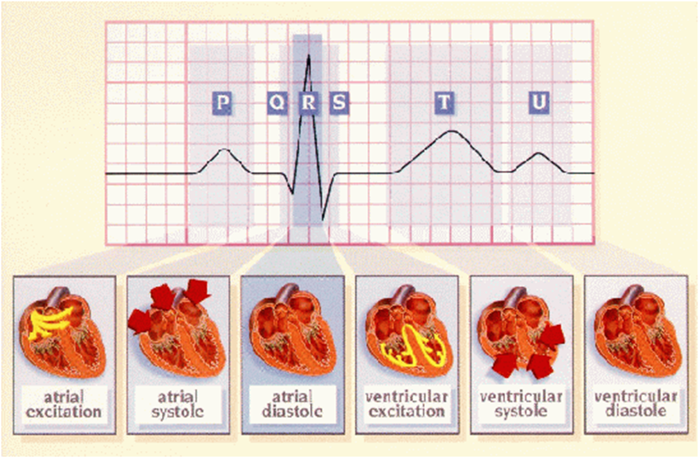 3 Langkah Mudah Interpretasi EKG - Catatan Dokter