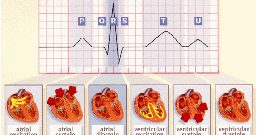 3 Langkah Mudah Interpretasi EKG - CatatanDokter