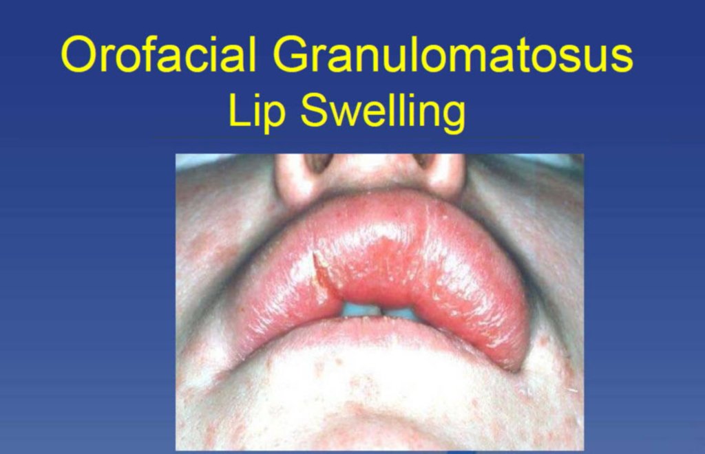 Dermatology For Dentists and Dental Students: Oral Pathology for Doctors