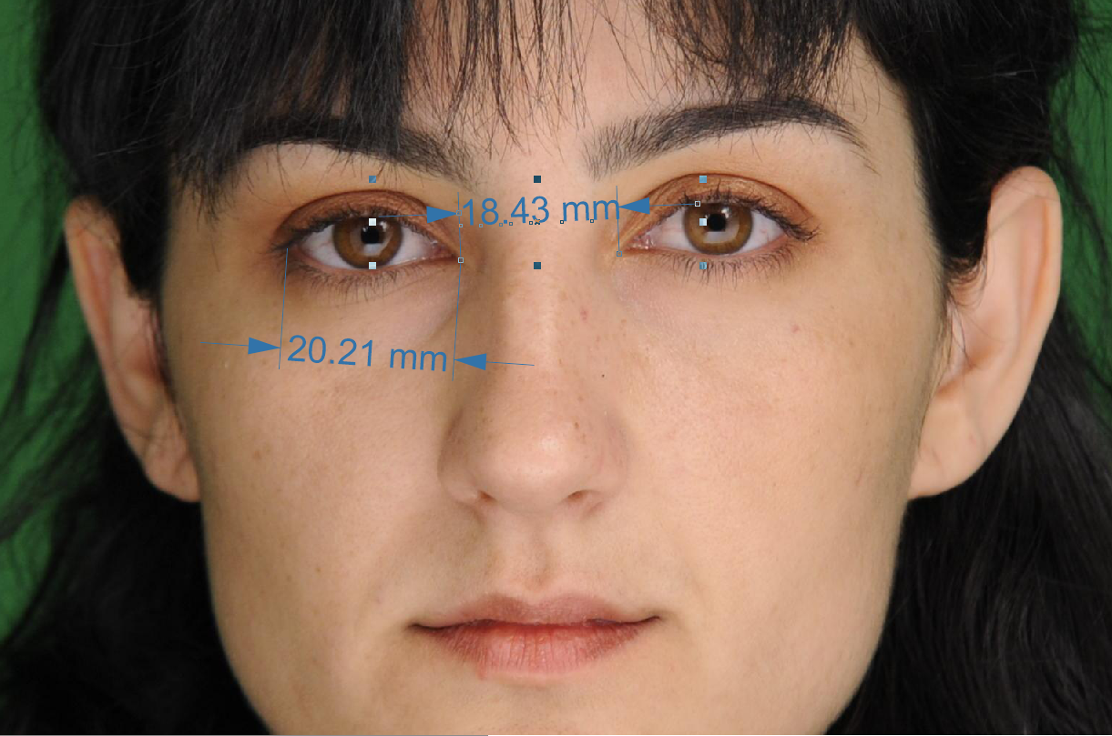 Creating a Database for Wide-Close-Normal Eyes