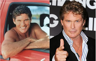 Has David Hasselhoff had Plastic Surgery Before and After Botox ...